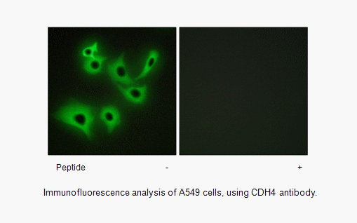 CDH4 Antibody | AAT Bioquest