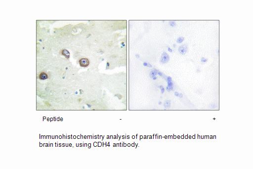 CDH4 Antibody | AAT Bioquest