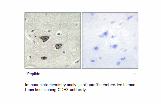 CDH8 Antibody | AAT Bioquest