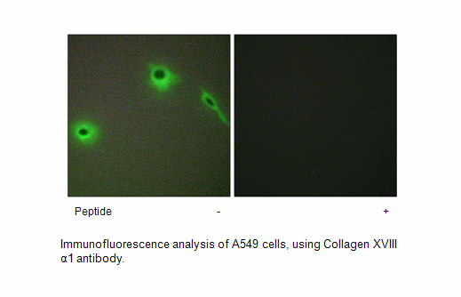 Collagen XVIII α1 Antibody | AAT Bioquest