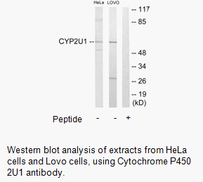 Cytochrome P450 2U1 Antibody | AAT Bioquest