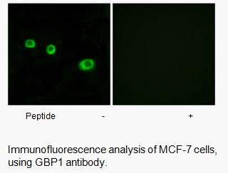 GBP1 Antibody | AAT Bioquest