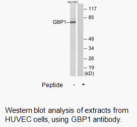 GBP1 Antibody | AAT Bioquest
