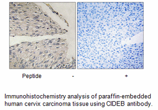 CIDEB Antibody | AAT Bioquest