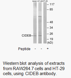 CIDEB Antibody | AAT Bioquest