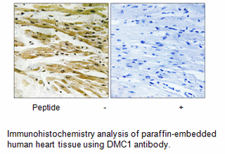 DMC1 Antibody | AAT Bioquest