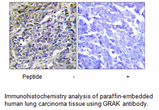 GRAK Antibody | AAT Bioquest