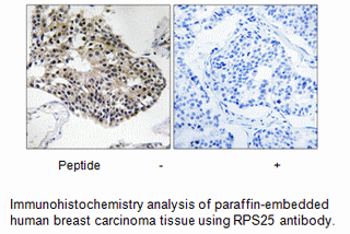 RPS25 Antibody | AAT Bioquest