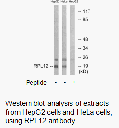 RPL12 Antibody | AAT Bioquest
