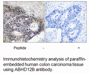 ABHD12B Antibody | AAT Bioquest