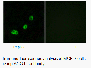 ACOT1 Antibody | AAT Bioquest