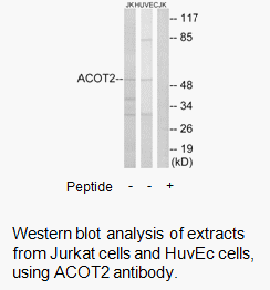 ACOT2 Antibody | AAT Bioquest