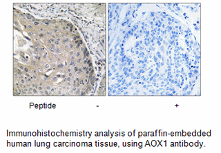 AOX1 Antibody | AAT Bioquest