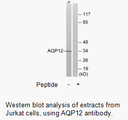 AQP12 Antibody | AAT Bioquest