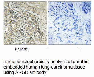 ARSD Antibody | AAT Bioquest