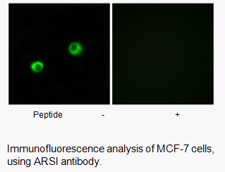 ARSI Antibody | AAT Bioquest