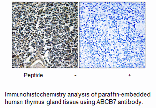 ABCB7 Antibody | AAT Bioquest