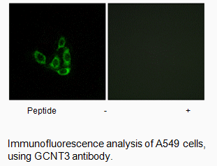 GCNT3 Antibody | AAT Bioquest