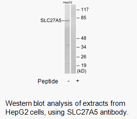 SLC27A5 Antibody | AAT Bioquest