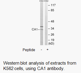 CA1 Antibody | AAT Bioquest