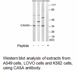 CA5A Antibody | AAT Bioquest