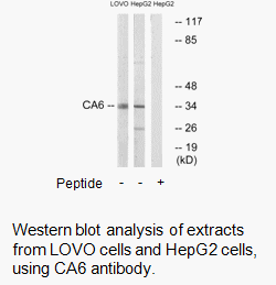 CA6 Antibody | AAT Bioquest