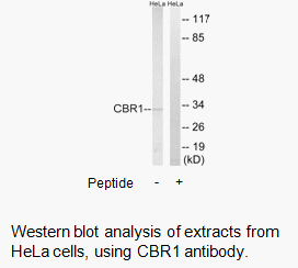 CBR1 Antibody | AAT Bioquest