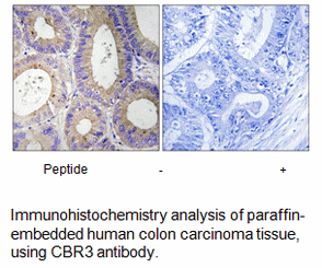 CBR3 Antibody | AAT Bioquest