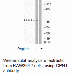 CPN1 Antibody | AAT Bioquest