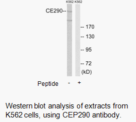CEP290 Antibody | AAT Bioquest