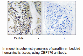 CEP170 Antibody | AAT Bioquest