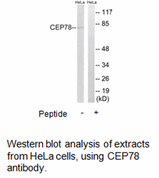 CEP78 Antibody | AAT Bioquest