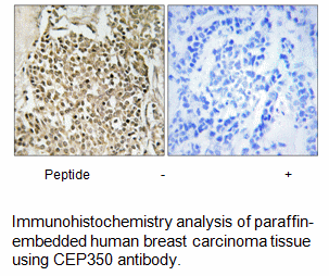 CEP350 Antibody | AAT Bioquest