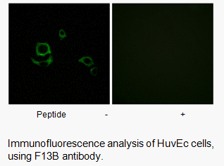 F13B Antibody | AAT Bioquest