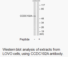 CCDC102A Antibody | AAT Bioquest