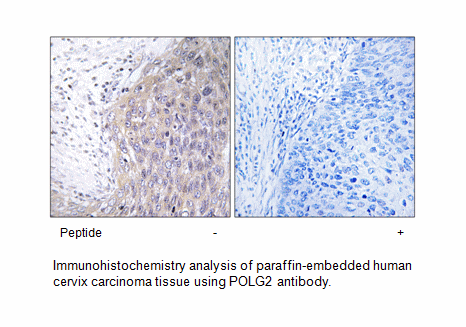 POLG2 Antibody | AAT Bioquest