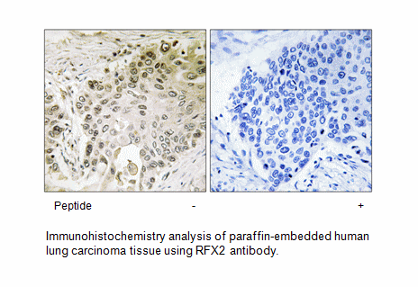 RFX2 Antibody | AAT Bioquest