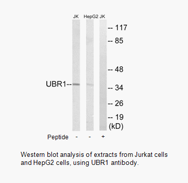 UBR1 Antibody | AAT Bioquest
