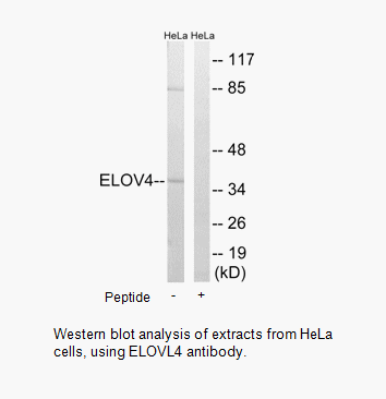 ELOVL4 Antibody | AAT Bioquest