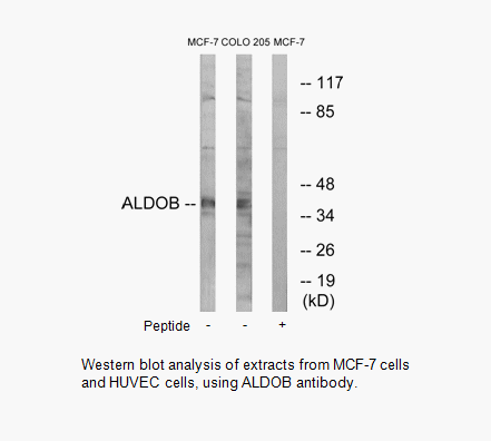 ALDOB Antibody | AAT Bioquest