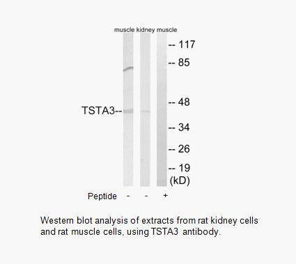 TSTA3 Antibody | AAT Bioquest