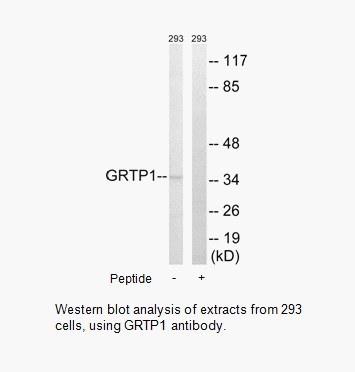 GRTP1 Antibody | AAT Bioquest
