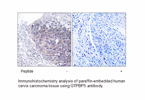 GTPBP5 Antibody | AAT Bioquest