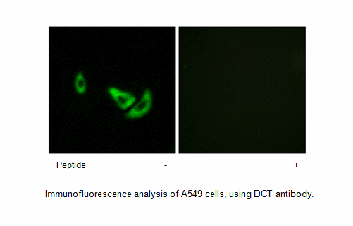 DCT Antibody | AAT Bioquest