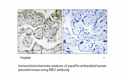ME2 Antibody | AAT Bioquest