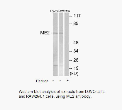 ME2 Antibody | AAT Bioquest