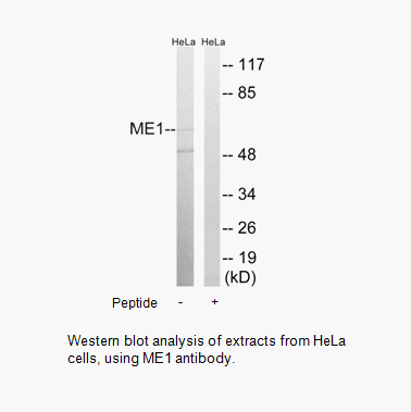 ME1 Antibody | AAT Bioquest