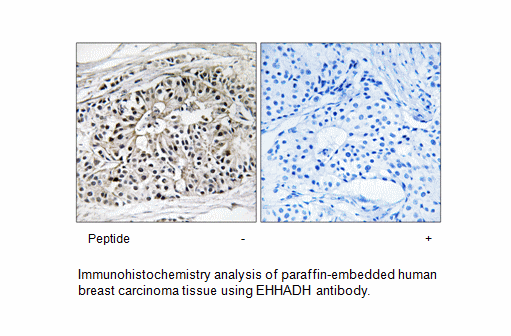 EHHADH Antibody | AAT Bioquest