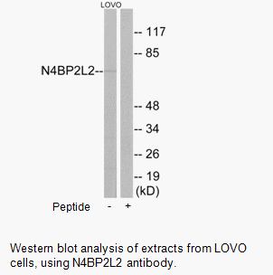 N4BP2L2 Antibody | AAT Bioquest