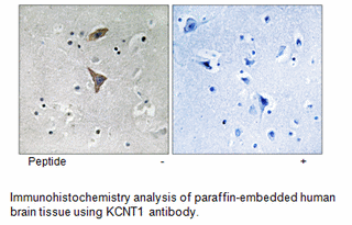 KCNT1 Antibody | AAT Bioquest